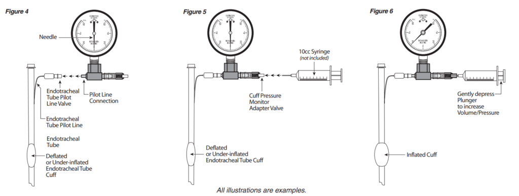 Cuff Pressure MONITOR – NIF METER® / ADAPTADOR CUFFÓMETRO – F I S I O M E D